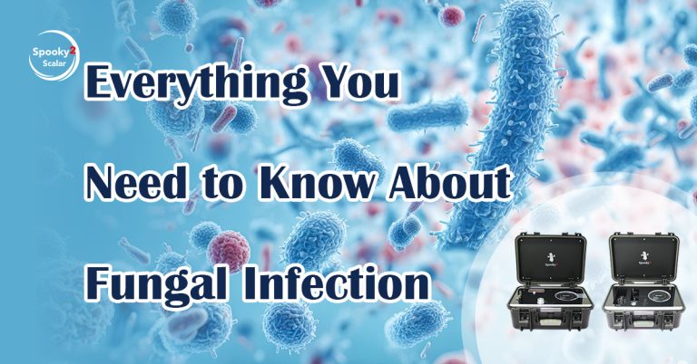 Everything You Need to Know About Fungal Infection – Spooky2 Scalar